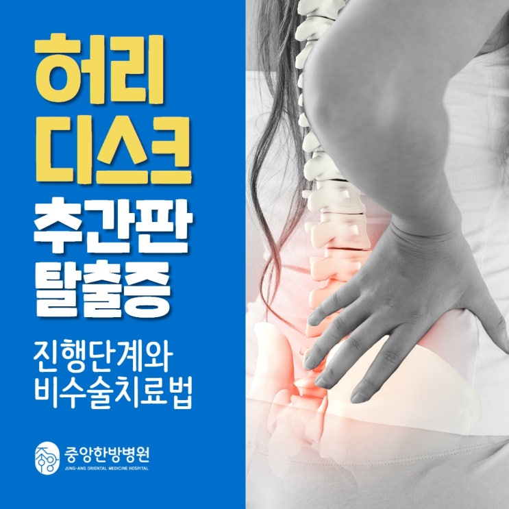허리 디스크 진행 단계별 증상과 비수술 치료법 네이버 블로그