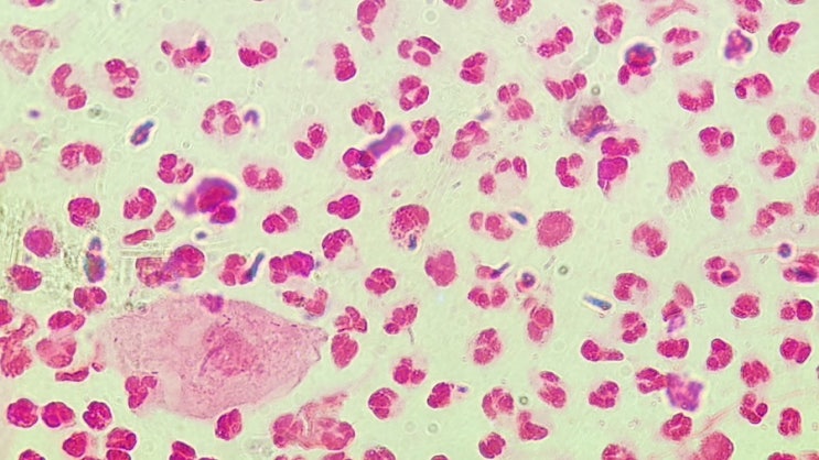 임상미생물학 Neisseria, Moraxella : 네이버 블로그