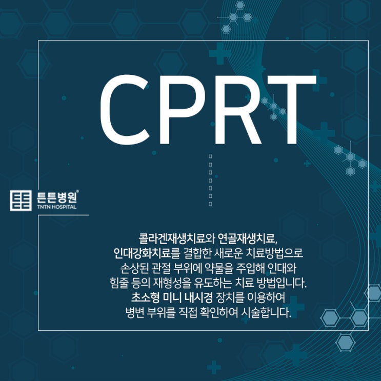 수원튼튼병원 : CPRT 연골세포 재생술 이란? : 네이버 블로그