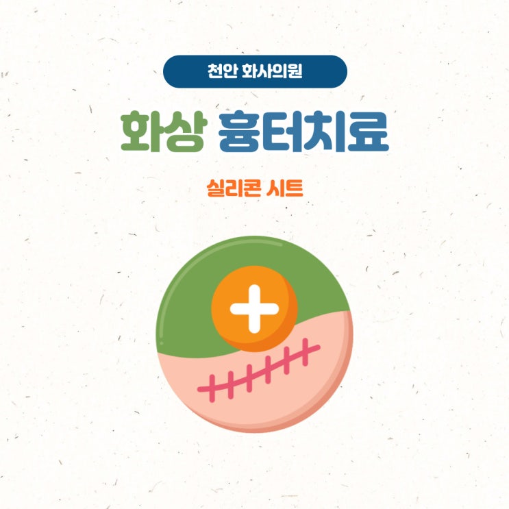 천안 화상치료 흉터 관리 실리콘 시트 네이버 블로그