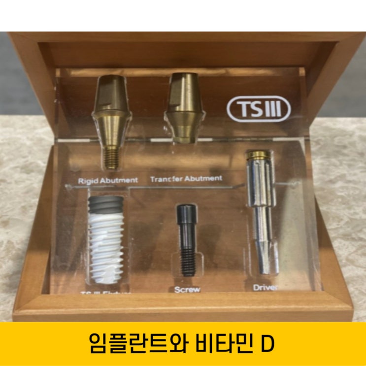 임플란트와 비타민 D : 네이버 블로그