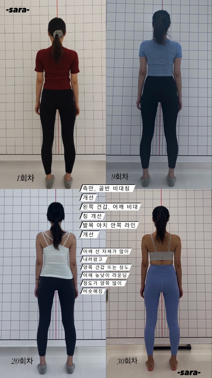 금호역 필라테스 금호동 필라테스 척추측만증체형교정 비포에프터 네이버 블로그