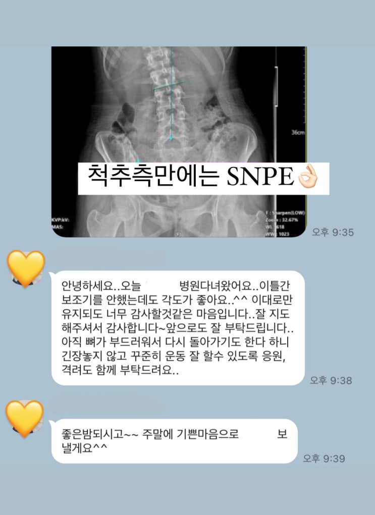 척추측만, 나빠지지 않으면 다행? (feat.SNPE 바른자세 척추운동) : 네이버 블로그