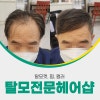탈모 전문 헤어샵 대구탈모커트 잘하는 이강헤어 네이버 블로그