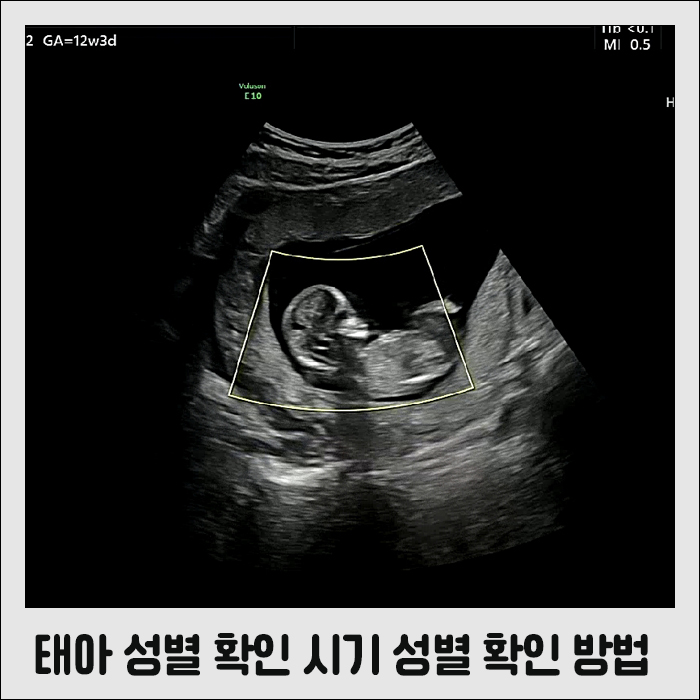 태아 성별 확인 시기 아기 성별 확인 방법 12주 각도법 임신 난황 위치 베이킹소다 네이버 블로그