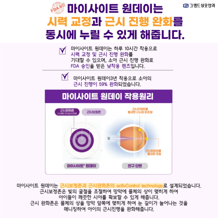 그랜드성모안과 성장기 어린이 근시억제 소프트렌즈 마이사이트 네이버 블로그