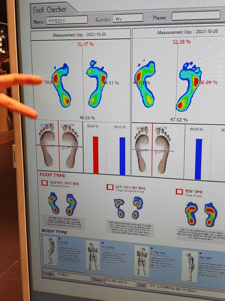 대구 수성구 아치깔창 평발교정깔창 디어밸런스 신세계백화점 대구점 네이버 블로그
