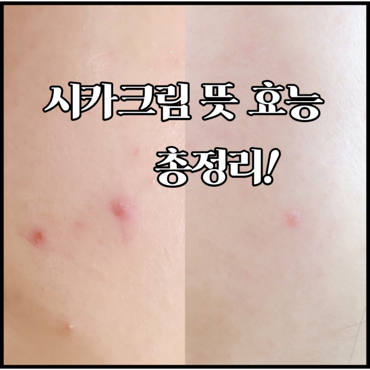 시카크림 뜻 효능 분석 좋은 시카크림 고르는법 추천템 네이버 블로그