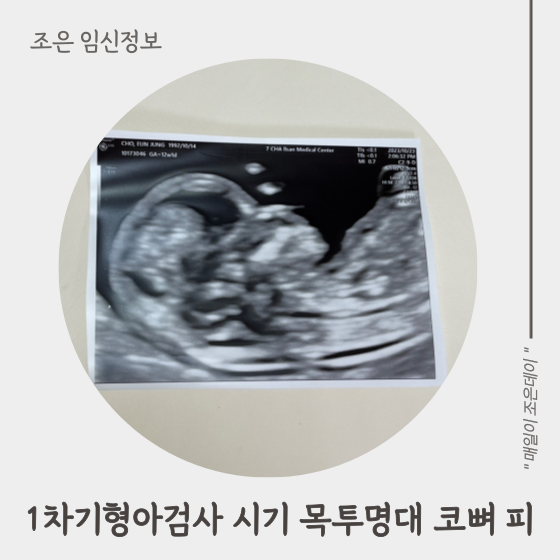 1차 기형아검사 시기 목투명대 코뼈 피검사 니프티 네이버 블로그