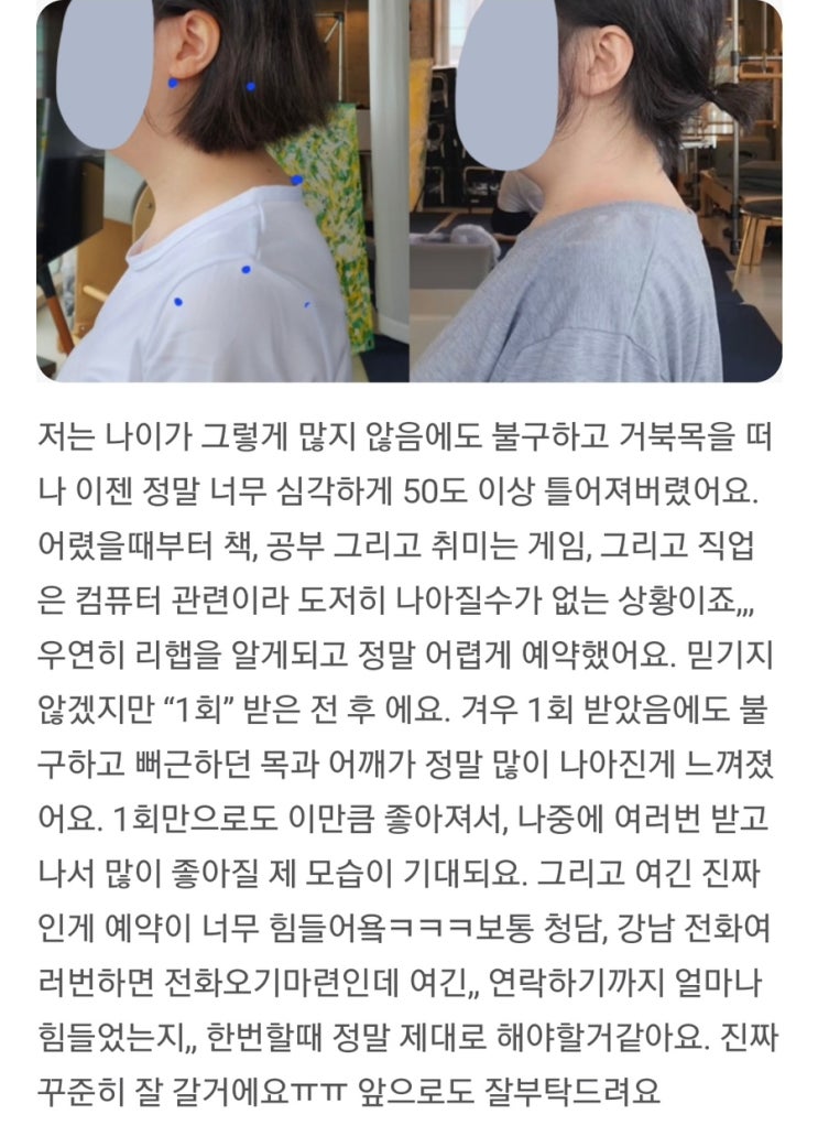 공지 재활 및 체형 교정 프로그램 비용 및 기간 안내 네이버 블로그