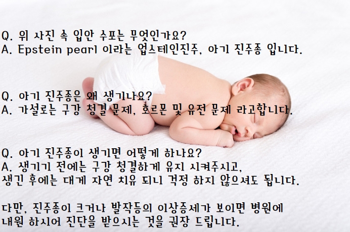 아기 진주종(Epstein pearl)- EAP육아사전 ep.1 : 네이버 블로그