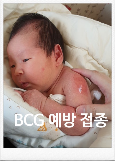 신생아 Bcg 예방 접종 피내용 경피용 주사 예방 주사 맞기 꿀팁 네이버 블로그