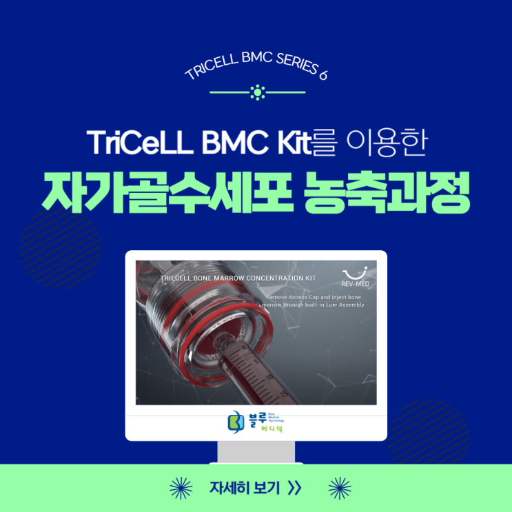 [정형외과 의료기기] TRICELL BMC SERIES 6 : TriCeLL BMC Kit를 이용한 자가골수세포 농축과정 ...