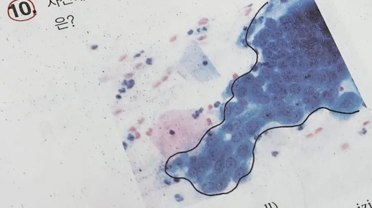 임상병리사 국가고시 D-37, 모의고사 : 네이버 블로그