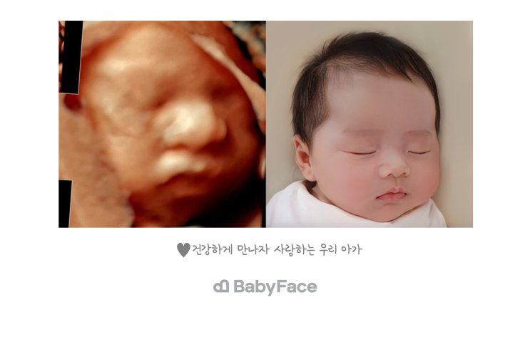 임신기록 27주 동탄제일병원 입체초음파 베이비페이스 후기 할인 사진비교 네이버 블로그