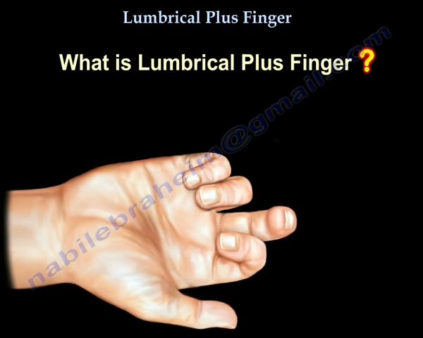 충양근양성수지(Lumbrical Plus Finger) - 경기광주추나 양벌동추나 양촌한의원 : 네이버 블로그
