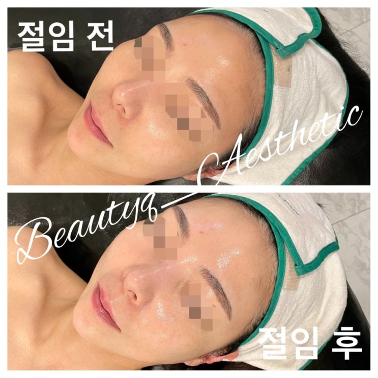 신월동윤곽관리 악건성피부 수분절임하는 비법 네이버 블로그