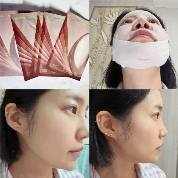 한혜진 마스크팩 추천 리프팅마스크 피부탄력관리 메디힐 레티놀 콜라겐 크림 윤곽마스크 네이버 블로그