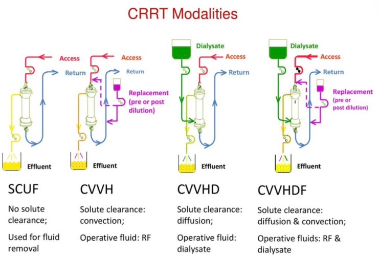 CRRT mode 모드 공부하기 SCUF, CVVH, CVVHD, CVVHDF : 네이버 블로그