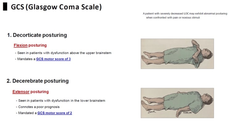 의학용어 LOC(의식수준), GCS, motor grade 신경학적 사정방법 : 네이버 블로그