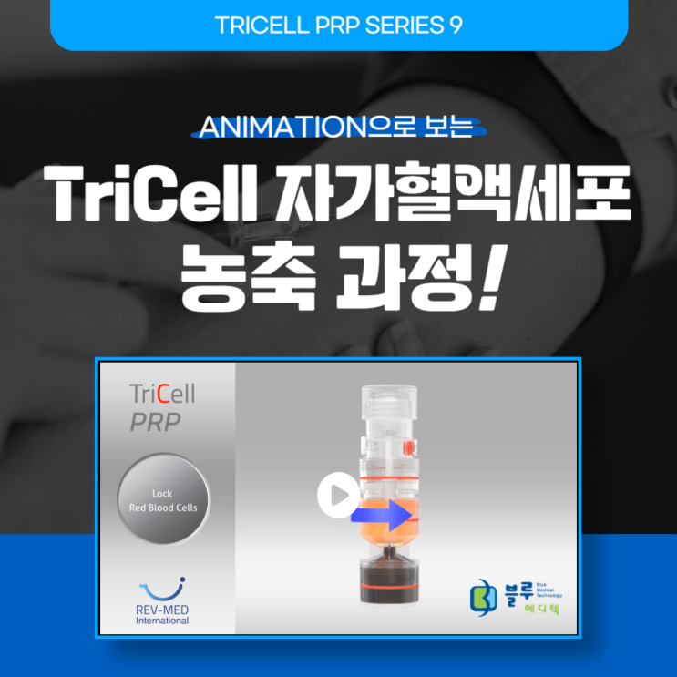 [성형외과 의료기기] TRICELL PRP SERIES 9: ANIMATION으로 보는 TriCell 자가혈액세포 농축 과정 ...