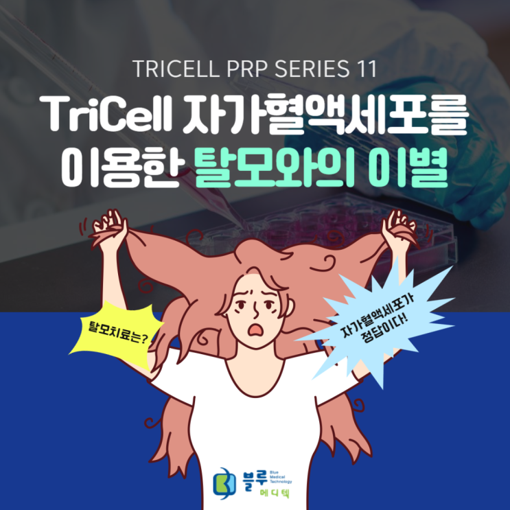 [정형외과 의료기기] TRICELL PRP SERIES 11: TriCell 자가혈액세포를 이용한 탈모와의 이별 : 네이버 블로그