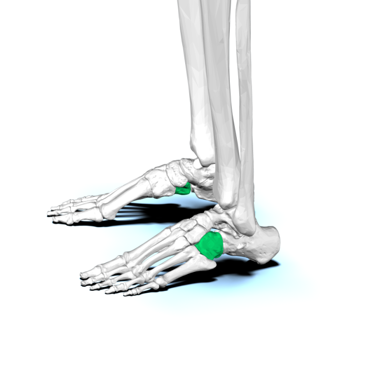 입방골 골절 개방 정복 및 내고정술 cuboid bone fracture ORIF plate : 네이버 블로그