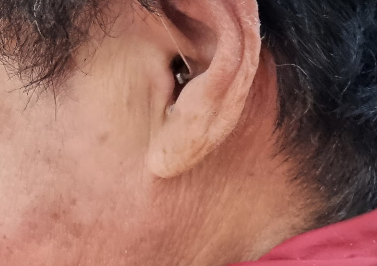 밀양보청기밀양독일보청기밀양시그니아독일보청기공식인정 전문센터~ 싸구려 보청기를 맞추었다가 낭패를 보신 어머님 네이버 블로그