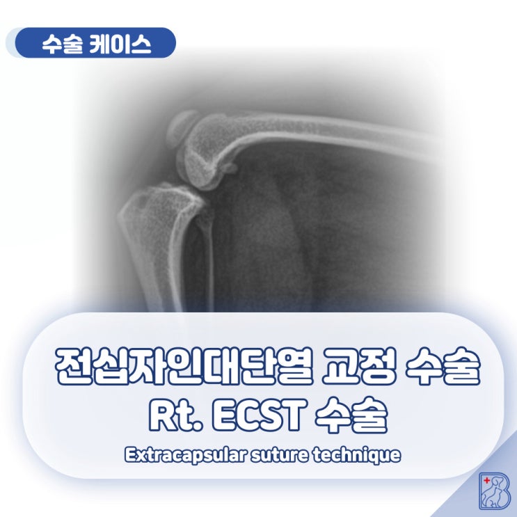 [춘천리본동물의료센터] 강아지 전십자인대단열 교정 수술 (Extracapsular suture technique) Rt ...