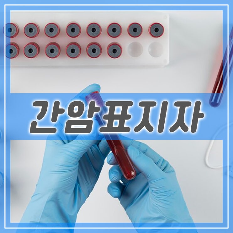 간암 표지자 검사란 Afp 수치 증가 원인 정상 범위 및 검사 방법 네이버 블로그