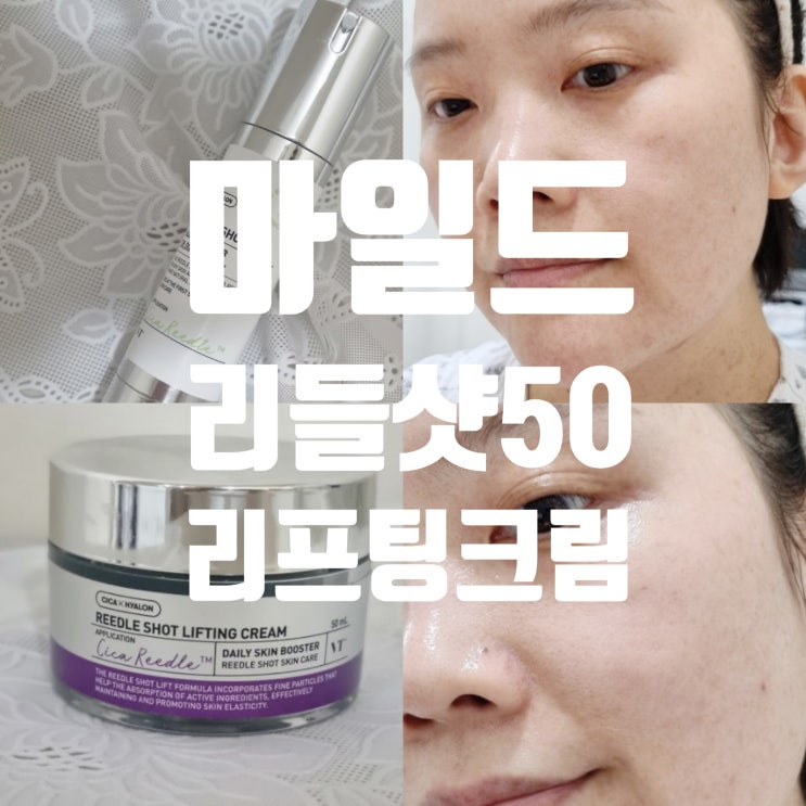 올리브영 품절 대란템 Vt 입문템 마일드 리들샷50 리들샷 리프팅 크림 후기 네이버 블로그