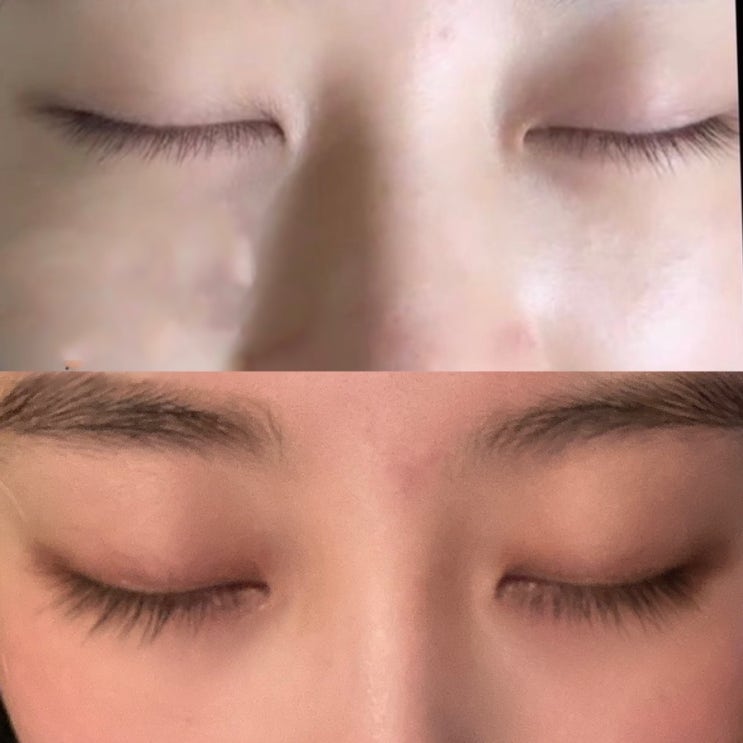 젬소 + 벤튼 속눈썹영영제 같이 6개월 써 본 내돈내산 후기 (진짜 짱 길어짐..) +부작용 : 네이버 블로그