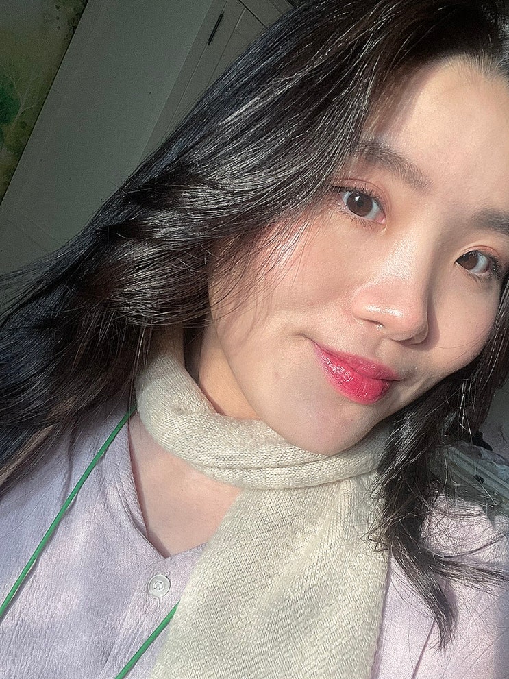강남 피부과 여드름흉터 피코프락셀 카이저 모공치료 후기 네이버 블로그