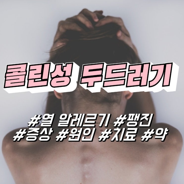 콜린성 두드러기 증상 및 원인 치료 약 열 알레르기 팽진 네이버 블로그