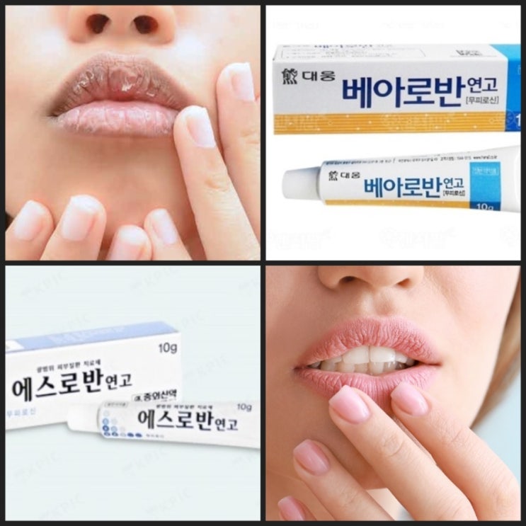 입술 갈라짐 건조종 원인 및 연고 입술 주변 주름 없애는 법 뜯는 버릇 관리방법 립밤 추천 네이버 블로그