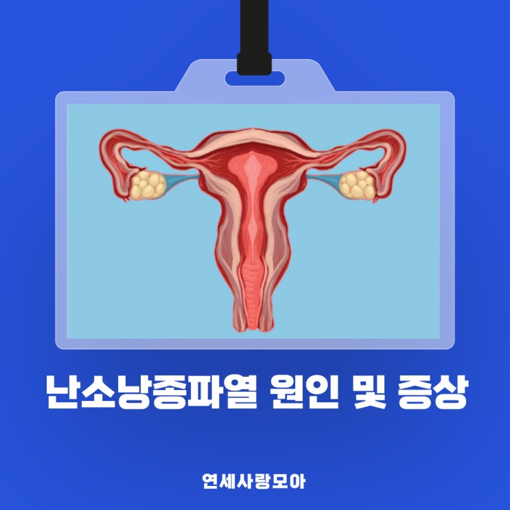 난소낭종파열 원인 및 증상 치료법까지 알아보아요 네이버 블로그