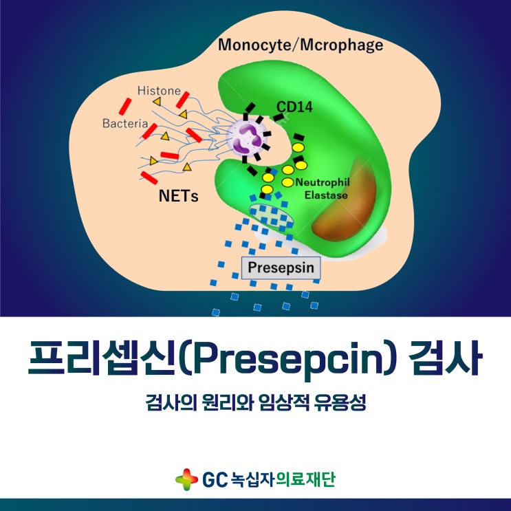 프리셉신(Presepsin) 검사원리와 임상적 유용성 : 네이버 블로그