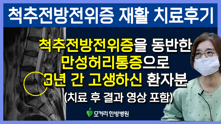 척추전방전위증을 동반한 만성허리통증으로 3년 간 고생하신 환자분 근육재활치료 후기 네이버 블로그