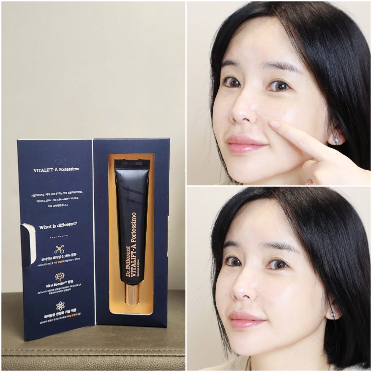 안티에이징 끝판왕 레티날 함량이 높아진 닥터디퍼런트 비타리프트 A 포르테시모 크림 네이버 블로그