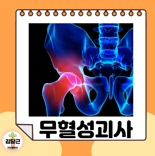 Avn 의학용어 무혈성괴사증 대퇴골두 무혈성 괴사 증상과 예방법 알아보기 네이버 블로그