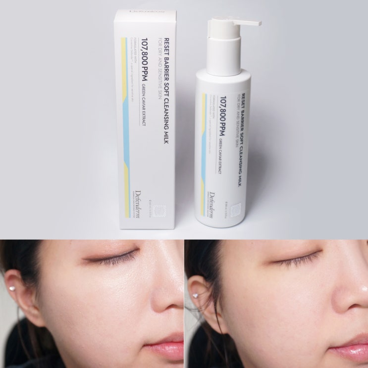 약산성클렌징, 디펜덤 리셋 베리어 소프트 클렌징 밀크 : 네이버 블로그