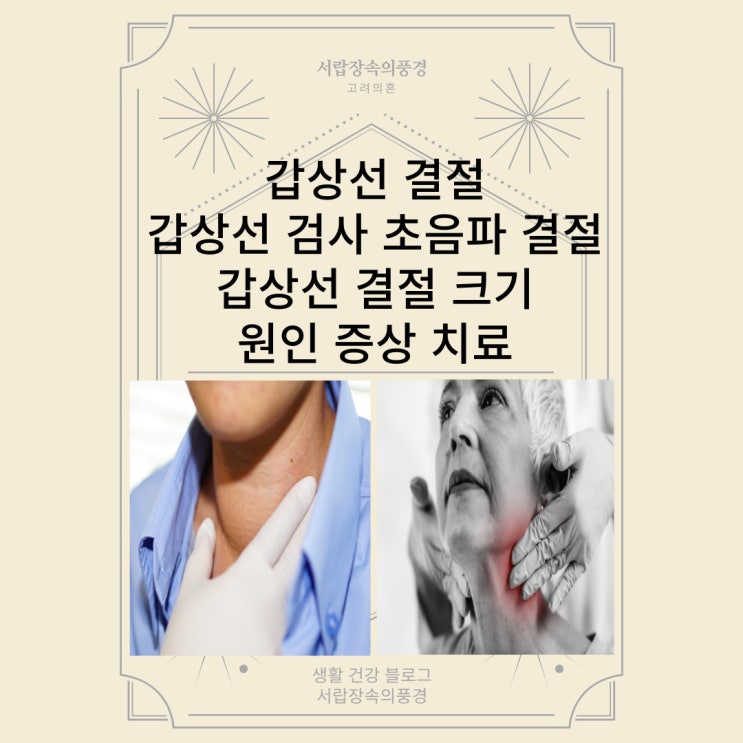 갑상선 결절 갑상선 검사 초음파 결절 갑상선 결절 크기 원인 증상 치료 네이버 블로그