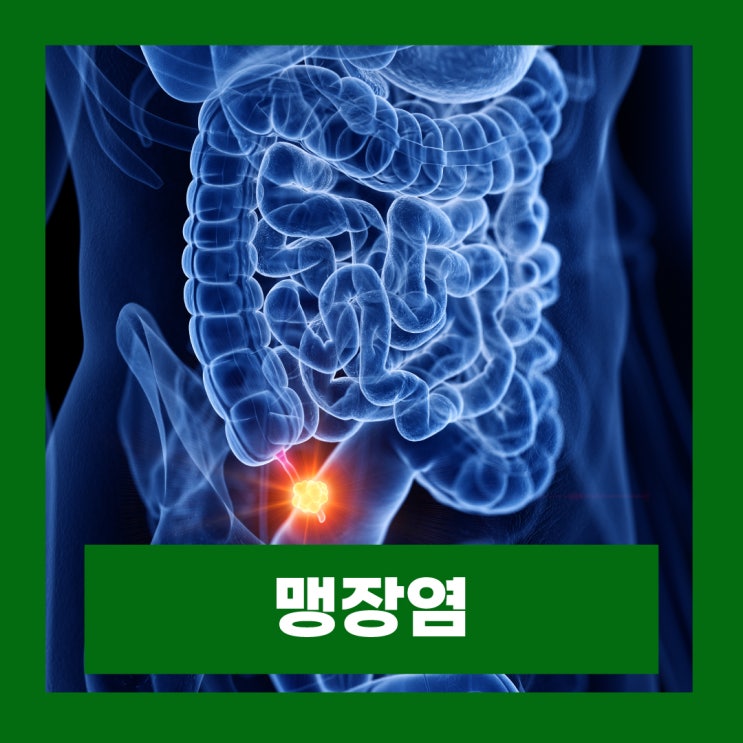 맹장염 원인 초기증상 남자 여자 맹장 위치 충수염 수술 회복 시간 네이버 블로그