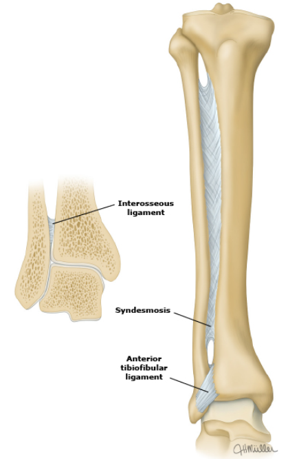 원위 경비인대결합 손상(syndesmotic ankle injury)의 진단 및 치료 : 네이버 블로그