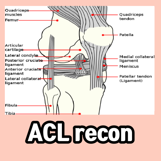 십자인대재건술 ACL recon. 수술준비 및 수술과정 : 네이버 블로그