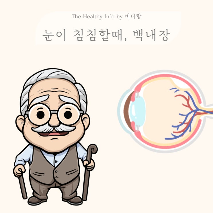 백내장 초기 증상 원인 수술 20대 눈이침침할때 영양제 네이버 블로그