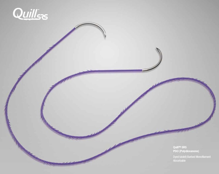 Global Top 3 Barbed Suture QUILL from U.S.A. : 네이버 블로그
