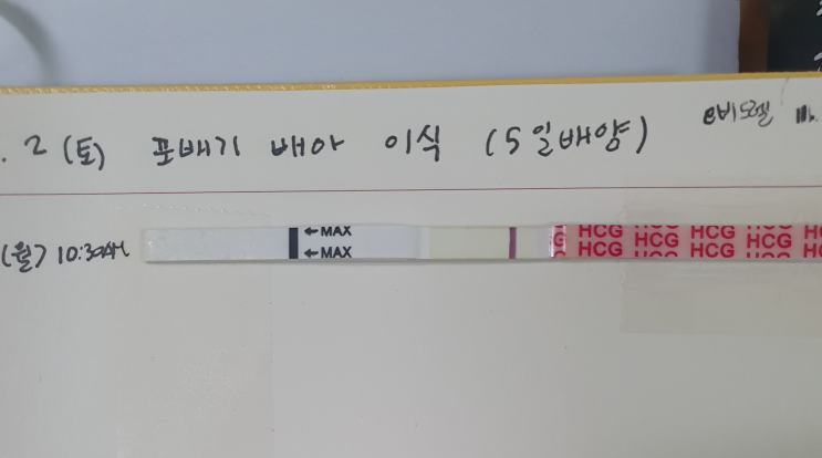 시험관 1차 5일배양 이식 후 증상 및 피검결과동결배아 개수 상봉마리아 네이버 블로그