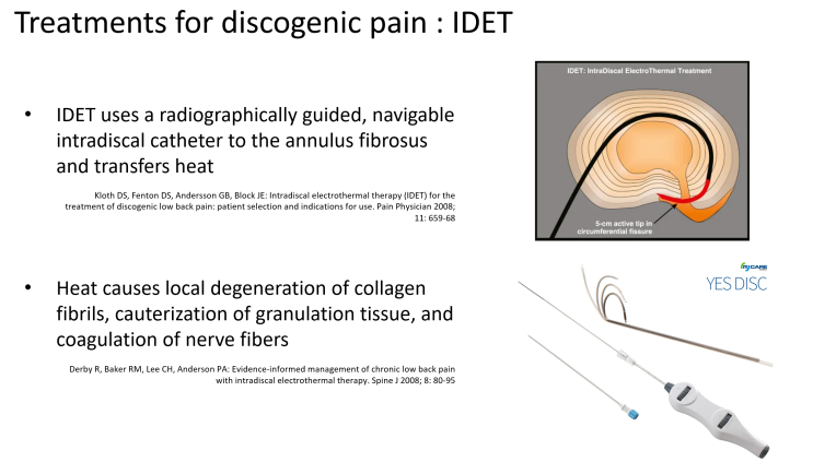 디스크성 요통과 디스크 내장증 Discogenic pain and Internal Disc Disruption (2 ...