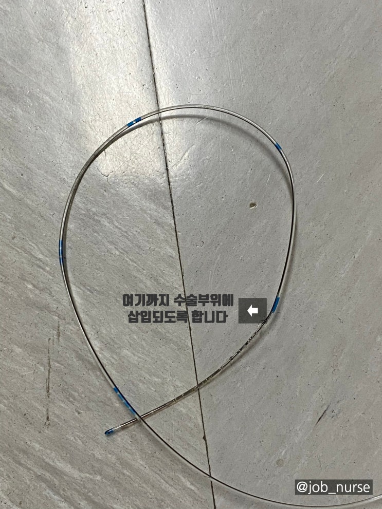 산부인과 간호사가 관찰한 페인버스터(pain buster) 효과 : 네이버 블로그